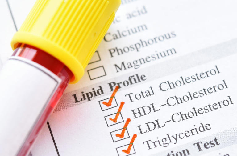 What everyone over 30 should know about the new cholesterol guidelines