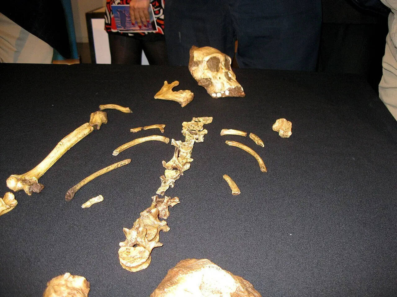 In 2008, a nine-year-old boy chasing his dog tripped over a rock and ...