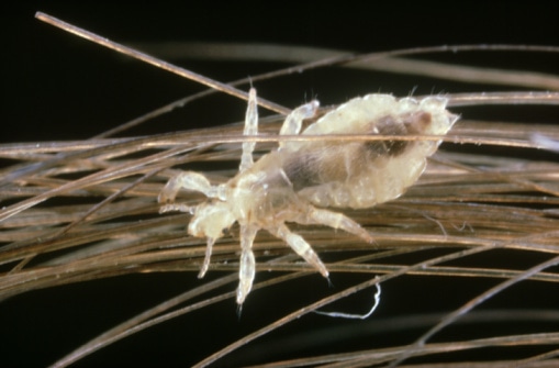 8 small critters that look like lice and how to tell the difference