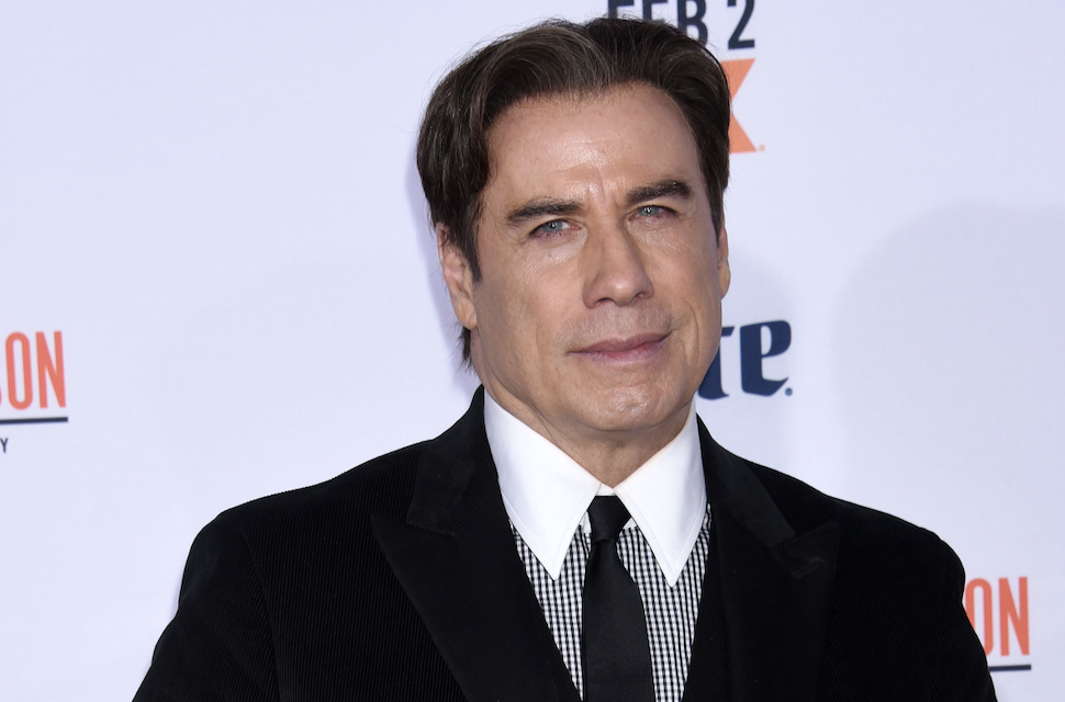 Famous men who used wigs, hairpieces, or hair transplants