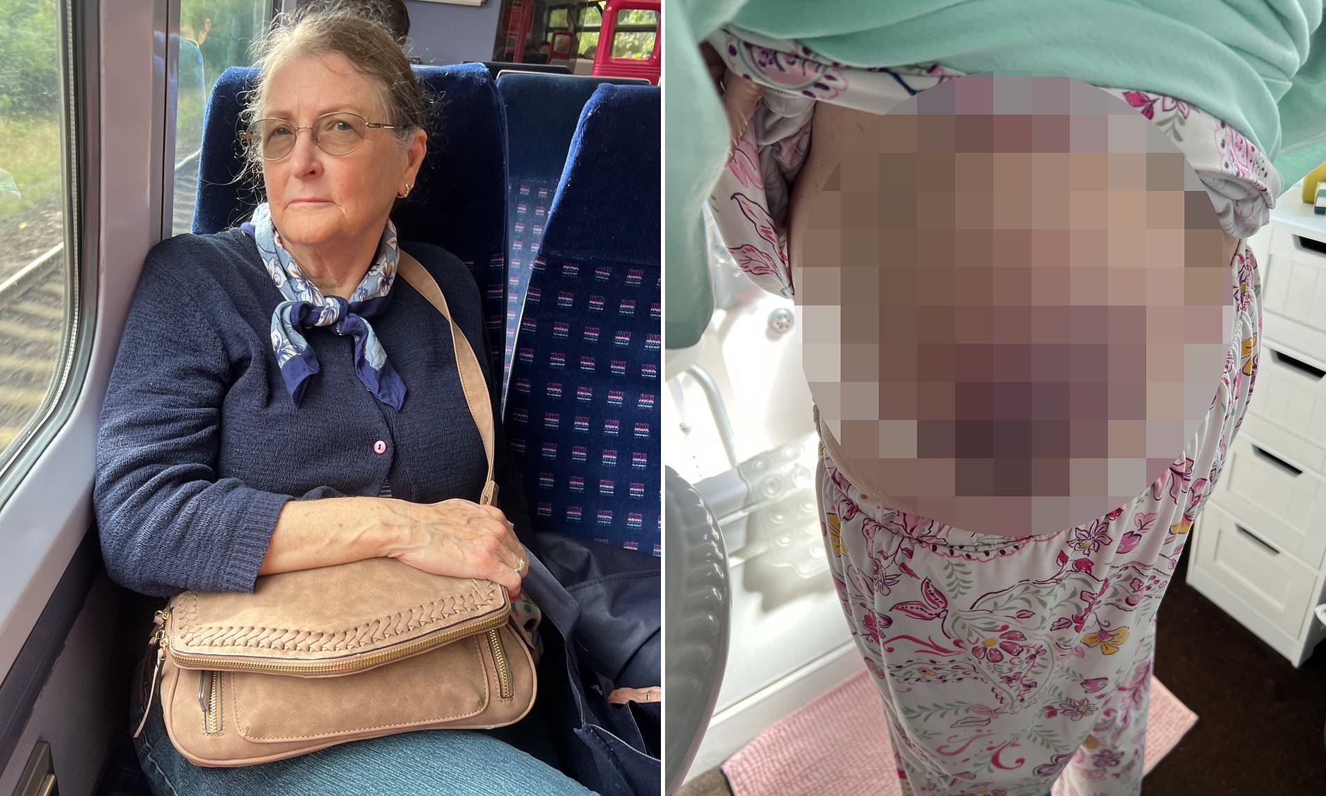 Retired oncology nurse, 75, can't afford £90 return ticket to travel to ...