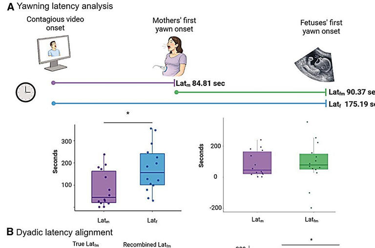 Like mother, like fetus: Study finds contagious yawning begins in the womb