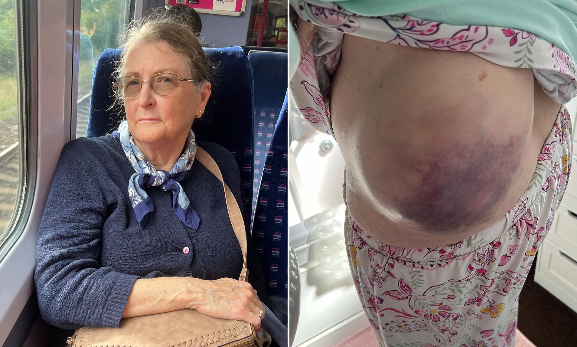 Retired oncologist nurse, 75, can't afford £90 return ticket to travel ...