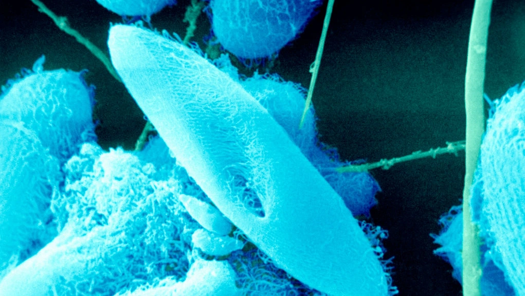 Pond organism rewrites genetic code by reassigning stop codons