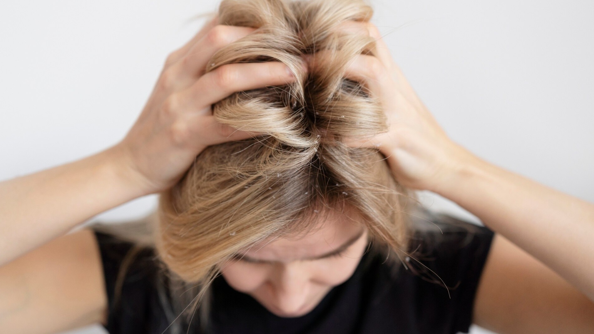 Hair that gets greasy quickly: the most common and underestimated causes