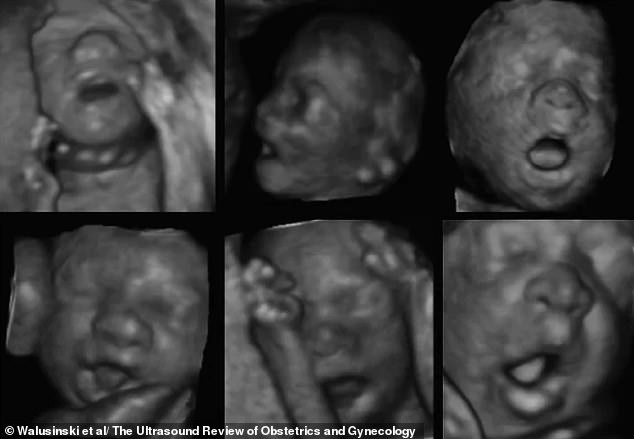 Contagious yawning begins in the womb, experts reveal - as foetuses are ...