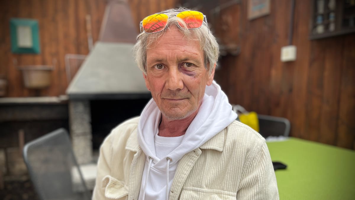 Bruno B (57) in Wohlen AG niedergeschlagen – von hinten!: «Ich kann ...
