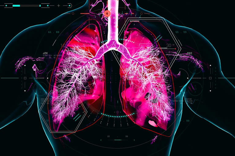 Chronic obstructive pulmonary disease develops over decades – and we ...