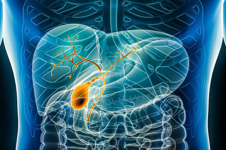 FDA approves Bizengri for rare bile duct cancer