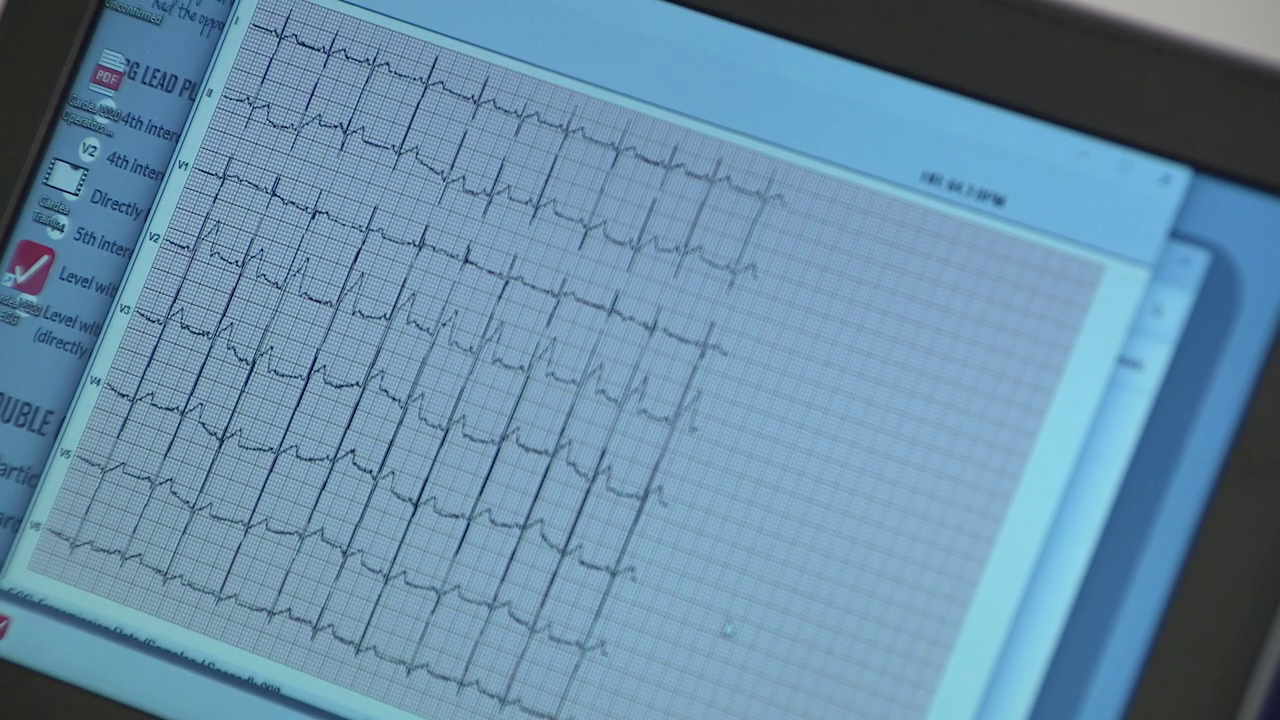 BayCare, Florida nonprofit offers heart screenings ahead of new ECG law ...