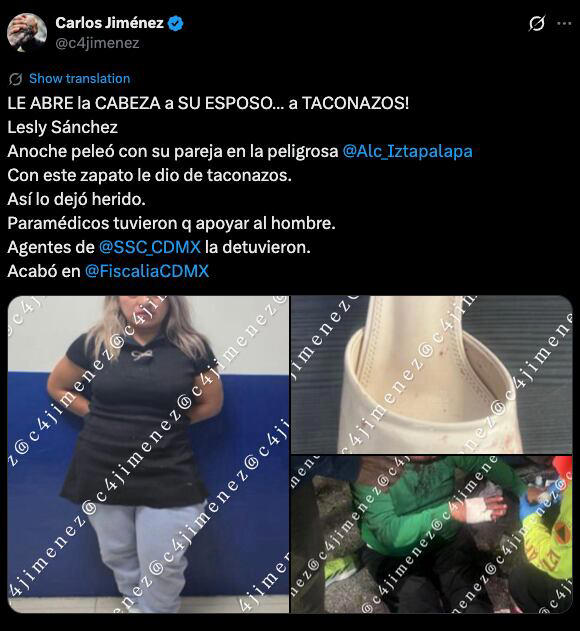 Mujer agarra a su esposo a taconazos; le rompe la cabeza y acaba ...