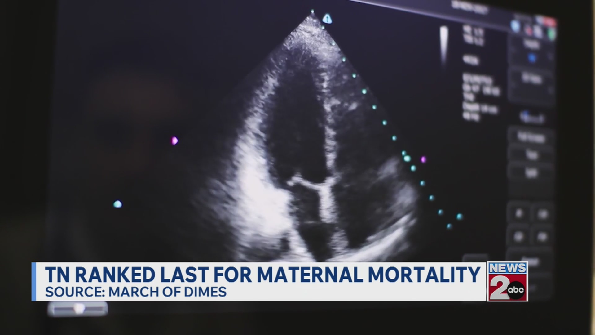 Tennessee ranks last for maternal mortality