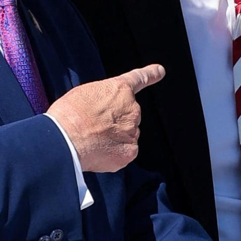 Trump, 79, masks bruising on both hands ahead of his big trip