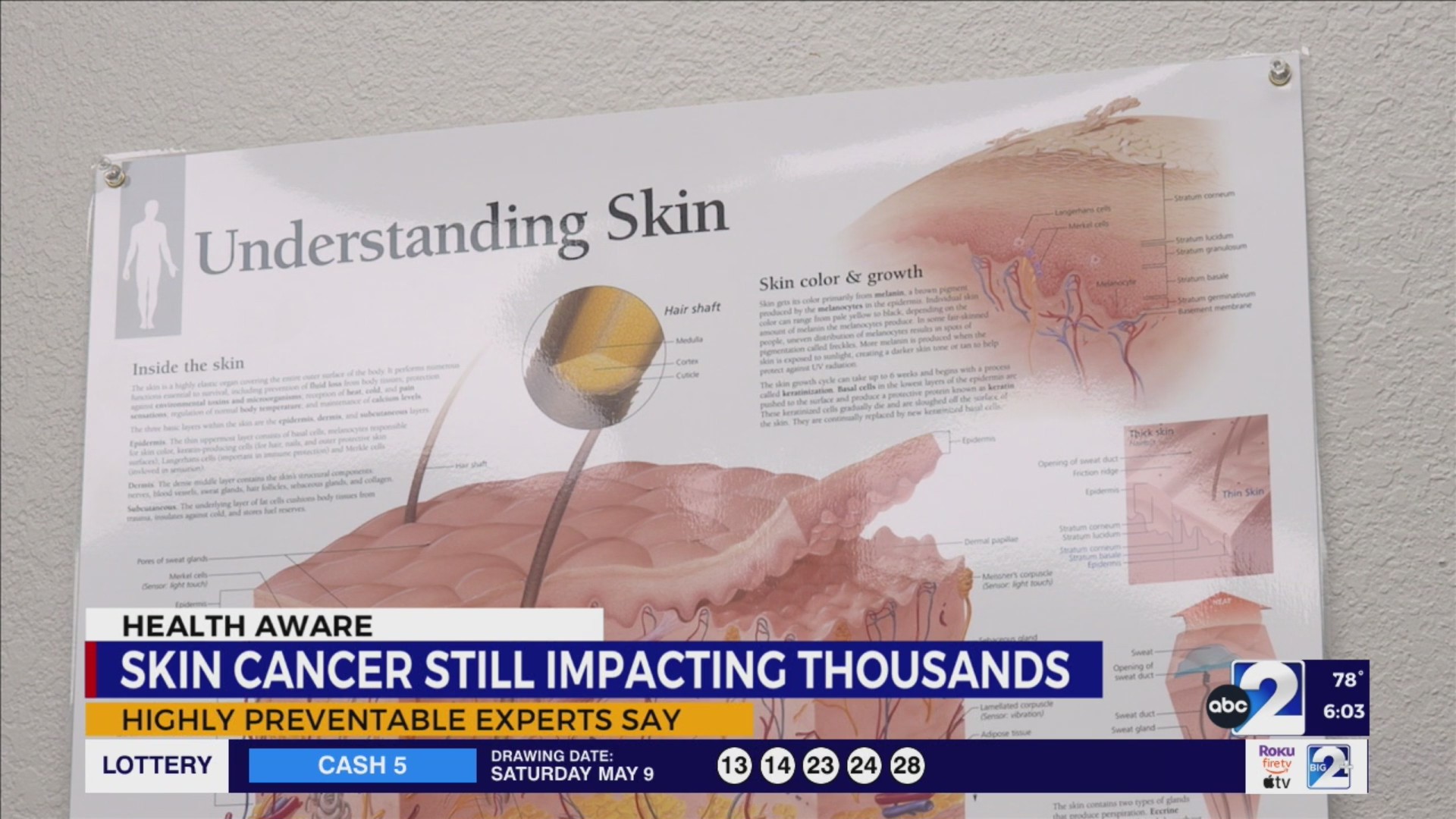 Skin cancer is preventable, but many Americans still overlook care