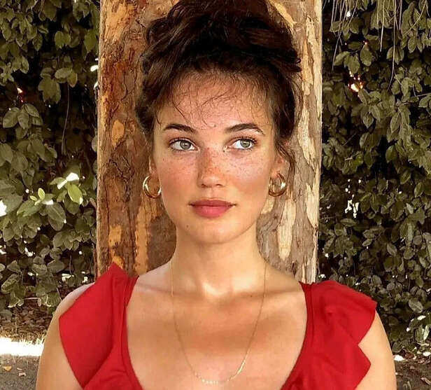 From TikTok to face: The rise of fawn freckles