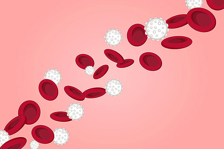 Gene-edited stem cell transplant shows promise for aggressive blood cancers