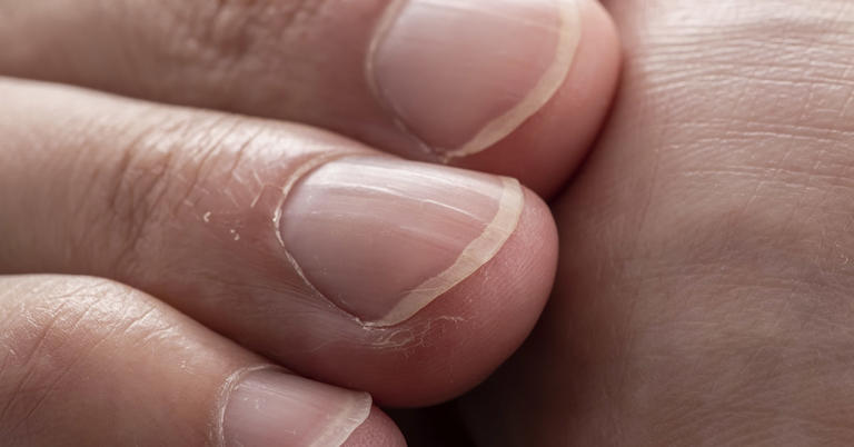 The health warning signs your body is giving you if you have these ...