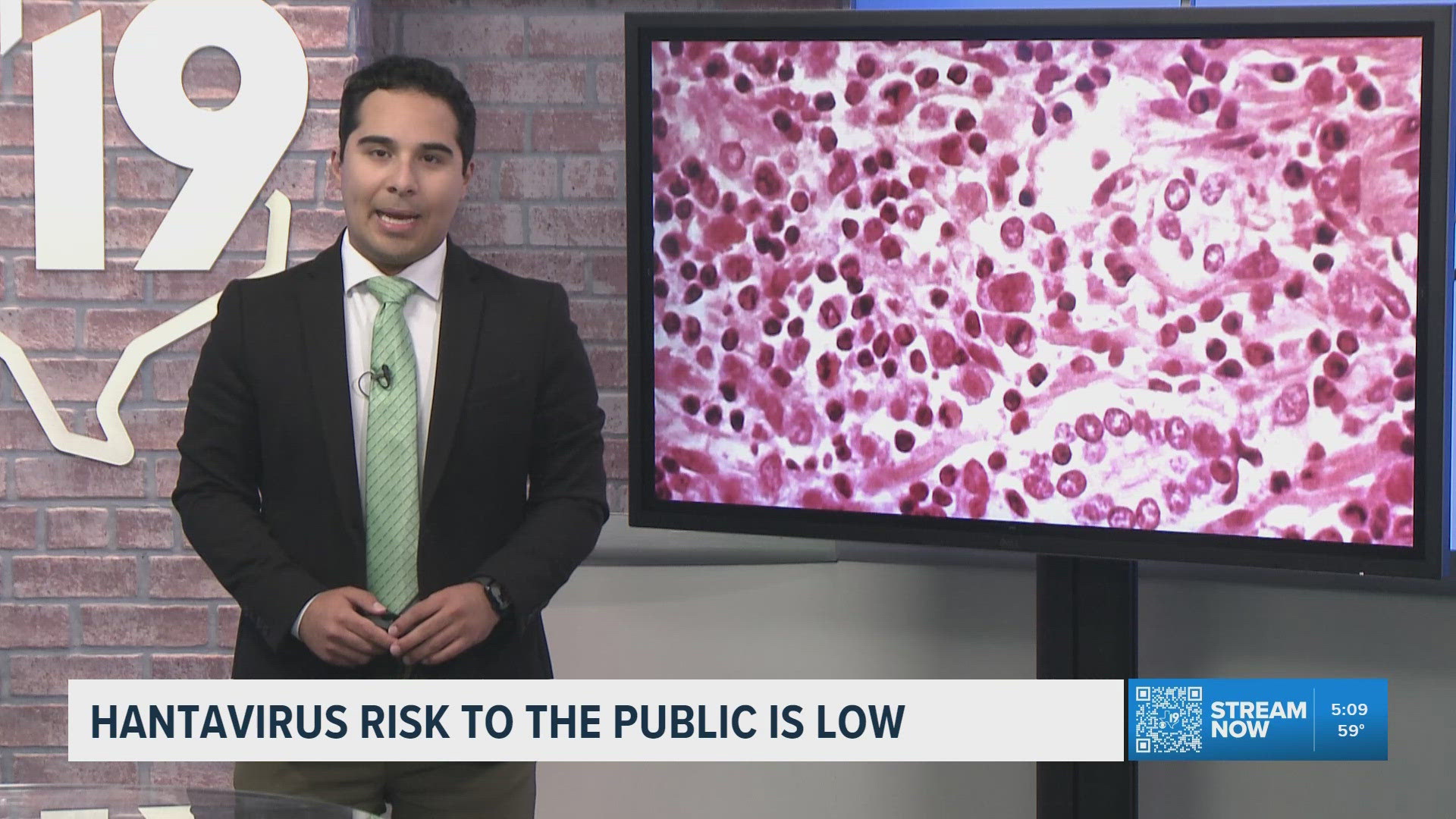 CDC says hantavirus risk to public far lower than COVID-19