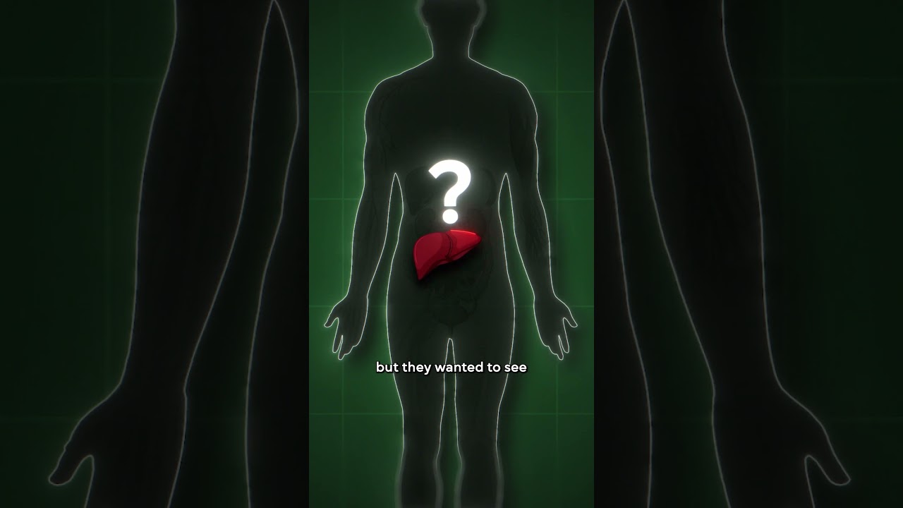 I can't believe this pig liver transplant worked!🐷 ️