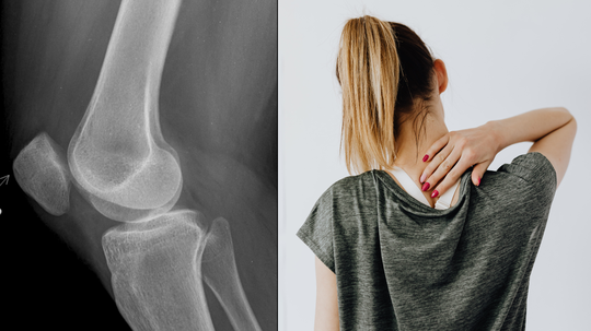 6 myths about joint pain and arthritis you should stop believing