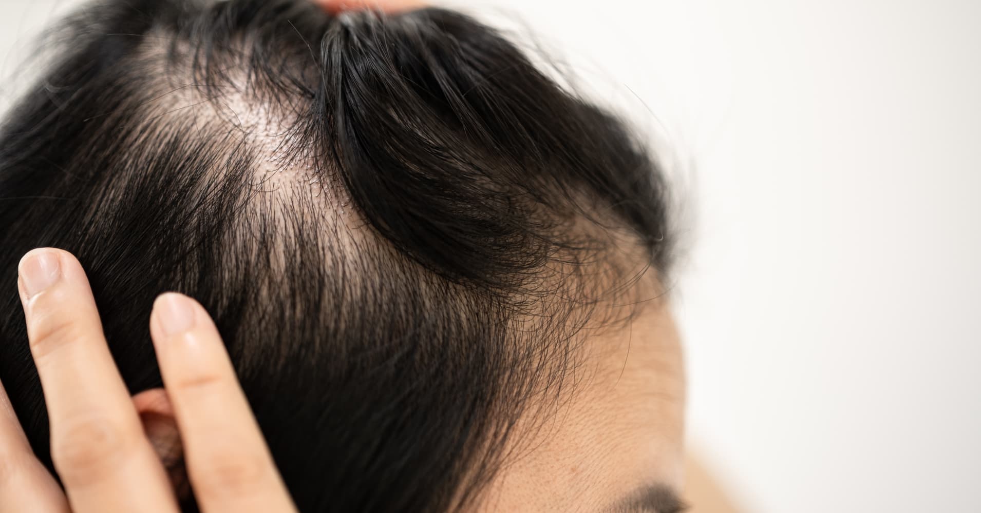 How GLP-1s are helping the hair care industry