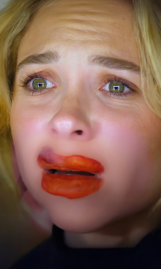 Taking lip filler way too far?