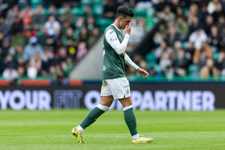 Hibs vs Motherwell injury and team news latest as David Gray goes full ...