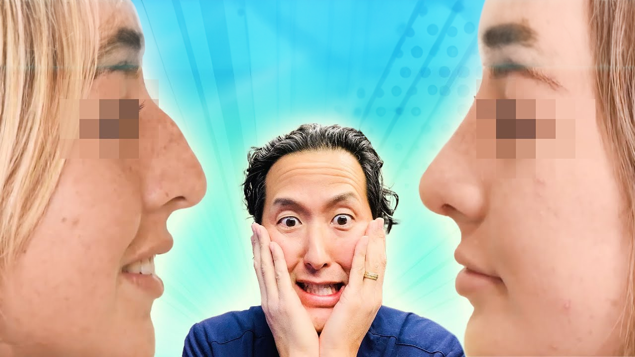 Can plastic surgery help with bullying?