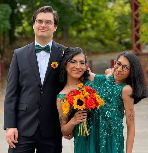 Conjoined twins share biggest worry after doctor's 'crushing' prognosis