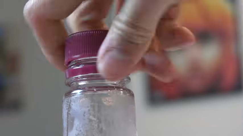 This is what happened to a liver after decades of extreme alcohol use