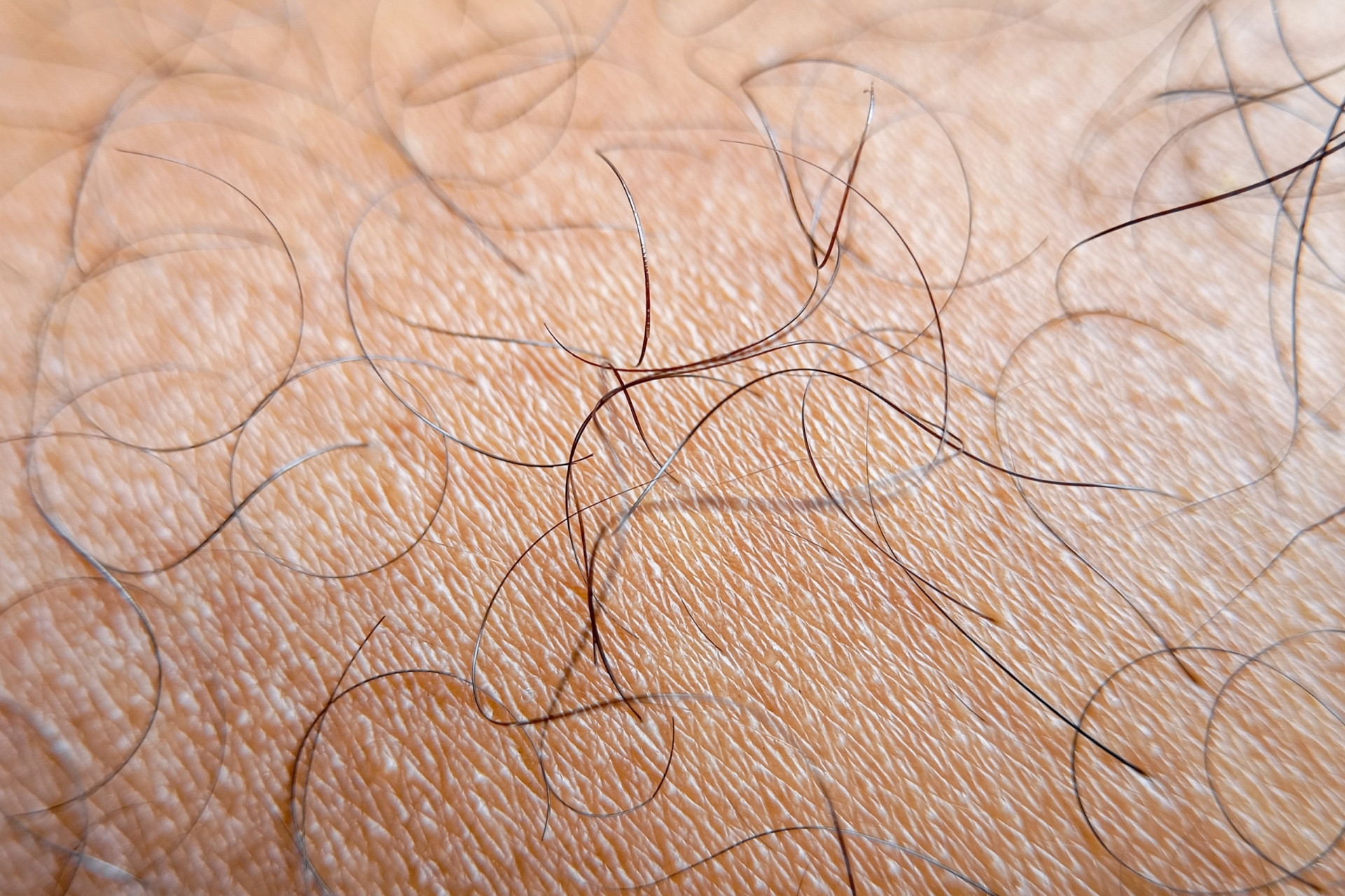 Why don’t humans have fur?