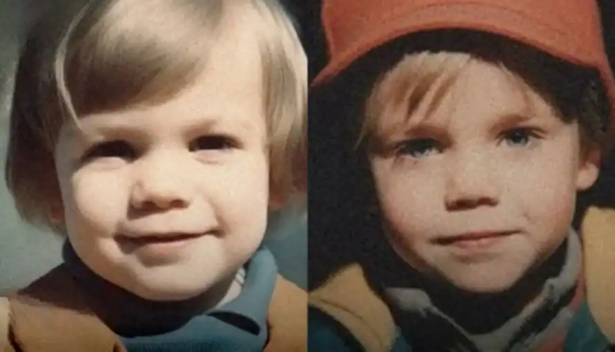A história de Patrick Christenson, o bebê que nasceu com as cicatrizes ...