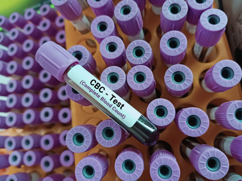 Which blood tests matter most for aging adults?