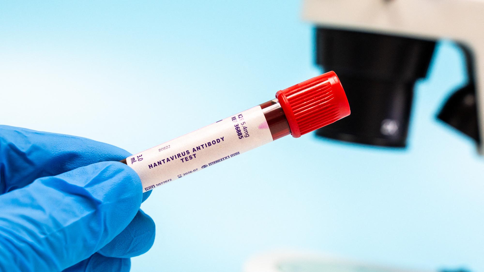 Hantavirus : la course contre la montre pour trouver la source de l ...