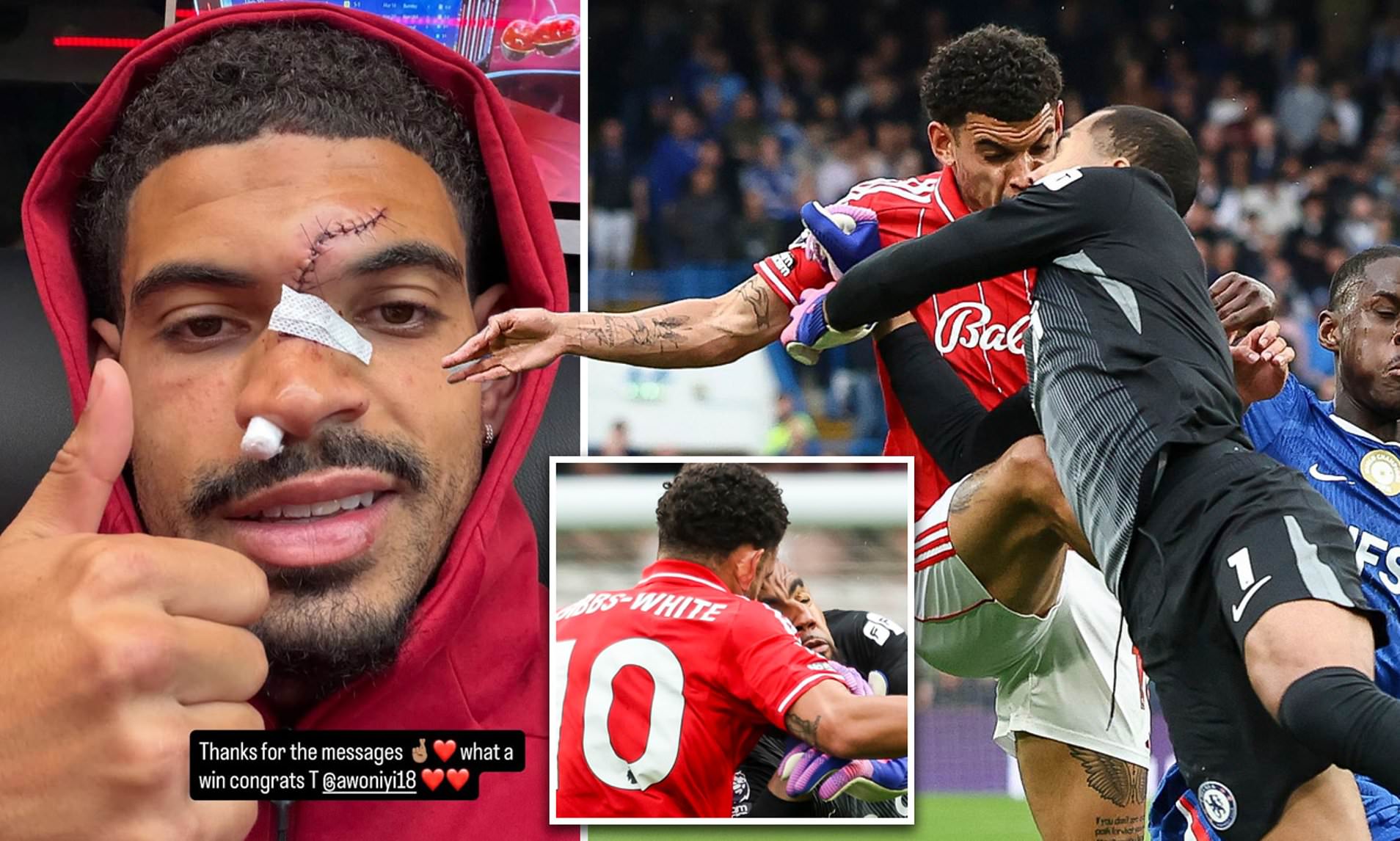 Gibbs-White shows off result of his horror head injury during ...