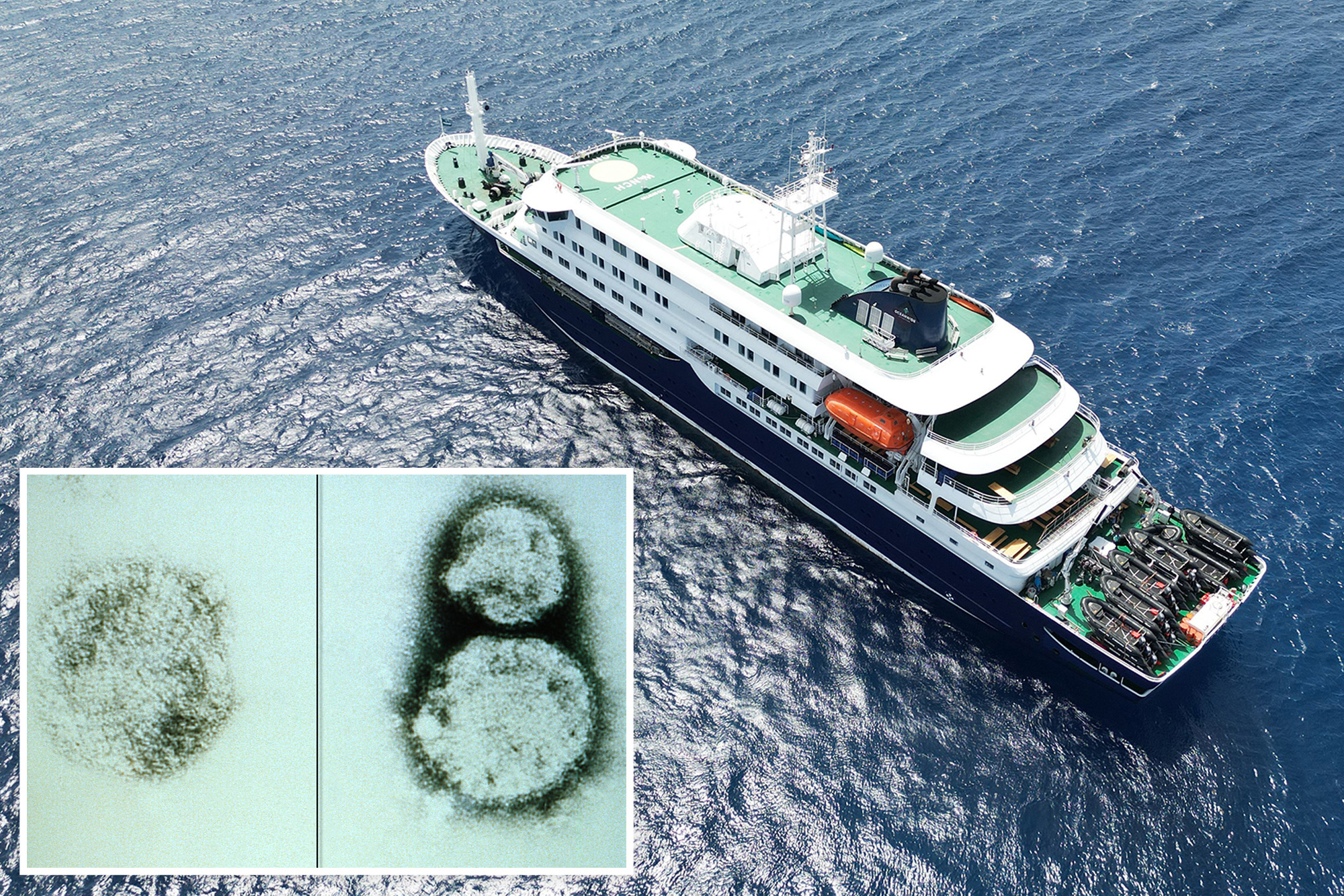 Inside the deadly hantavirus-infected cruise ship, MV Hondius, where 3 ...