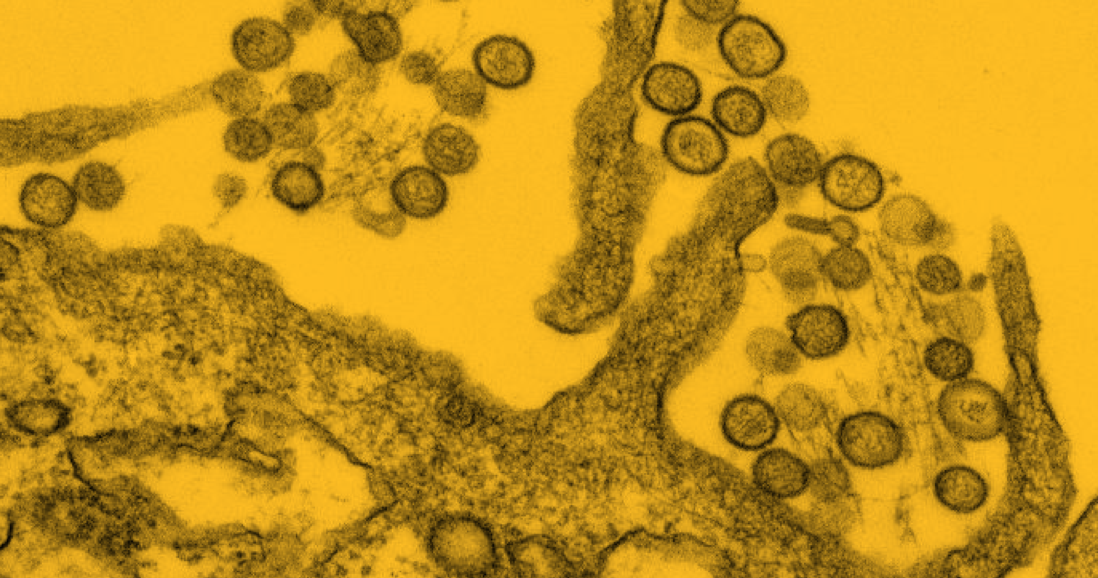 More hantavirus suspected from cruise ship. Latest on illnesses