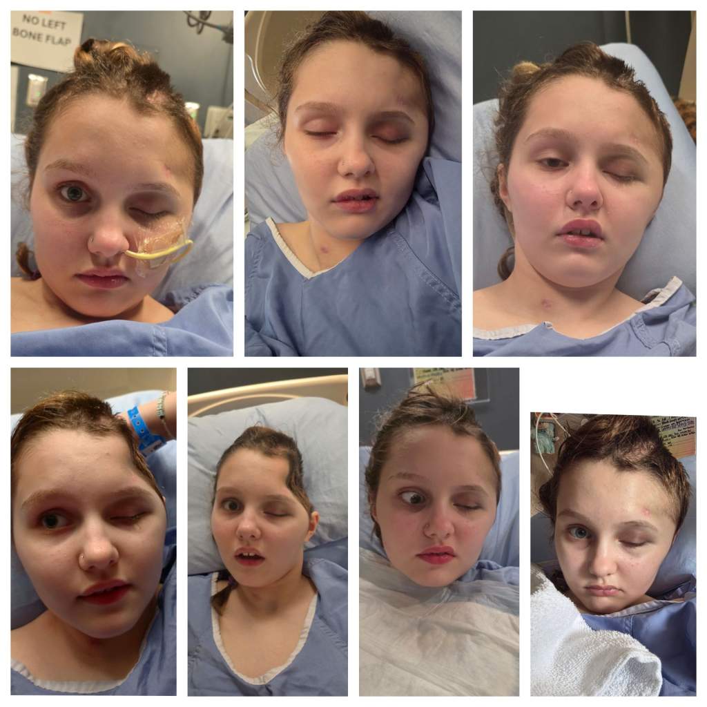 Maya Gebala could have undergone her last surgery, mother says