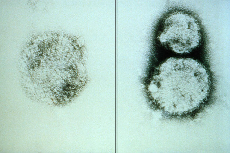 The two possible causes for the cruise ship hantavirus outbreak — one ...