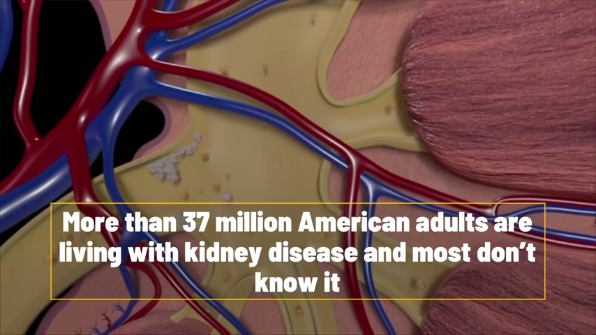 Are you ignoring these top 6 symptoms of kidney disease?