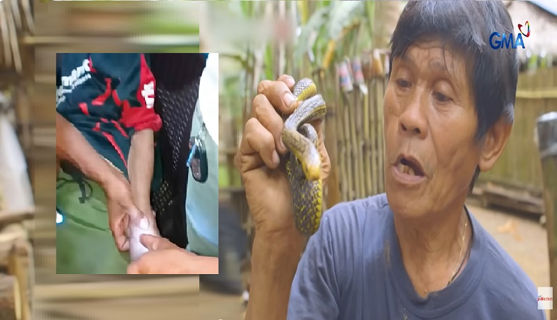 Can a man supposedly immune from snake venom survive a king cobra bite?