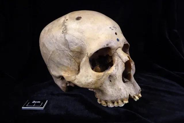 Las razones por las que el cráneo humano ha evolucionado en los últimos ...