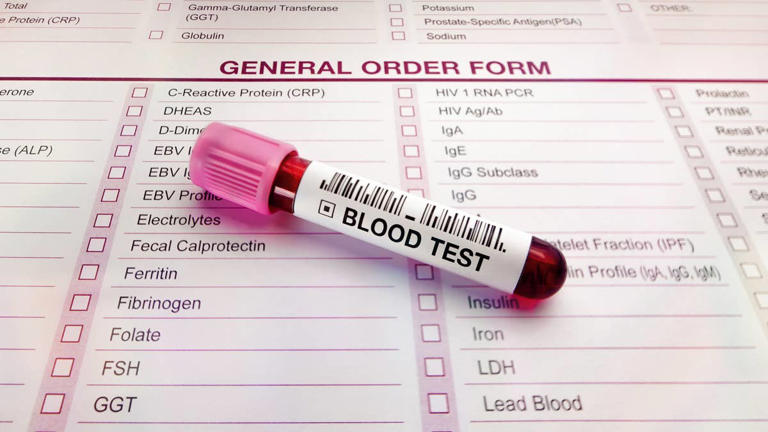 A cardiologist reveals the key lab results to monitor for heart health