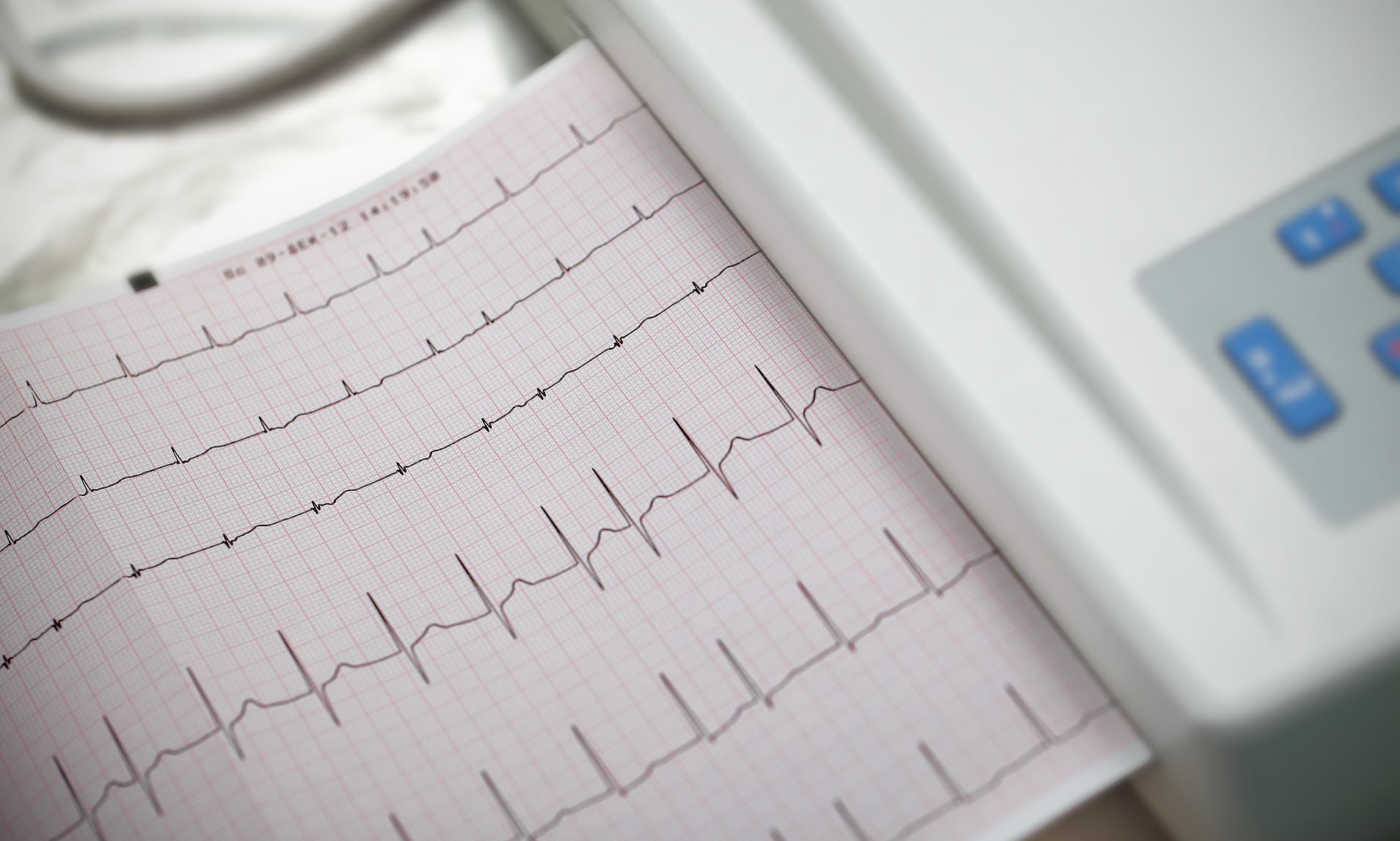 Experts pinpoint the exact heartbeat ranges that signal stroke risk ...