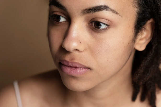 10 signs you’re overhydrating your skin (shocking truth)