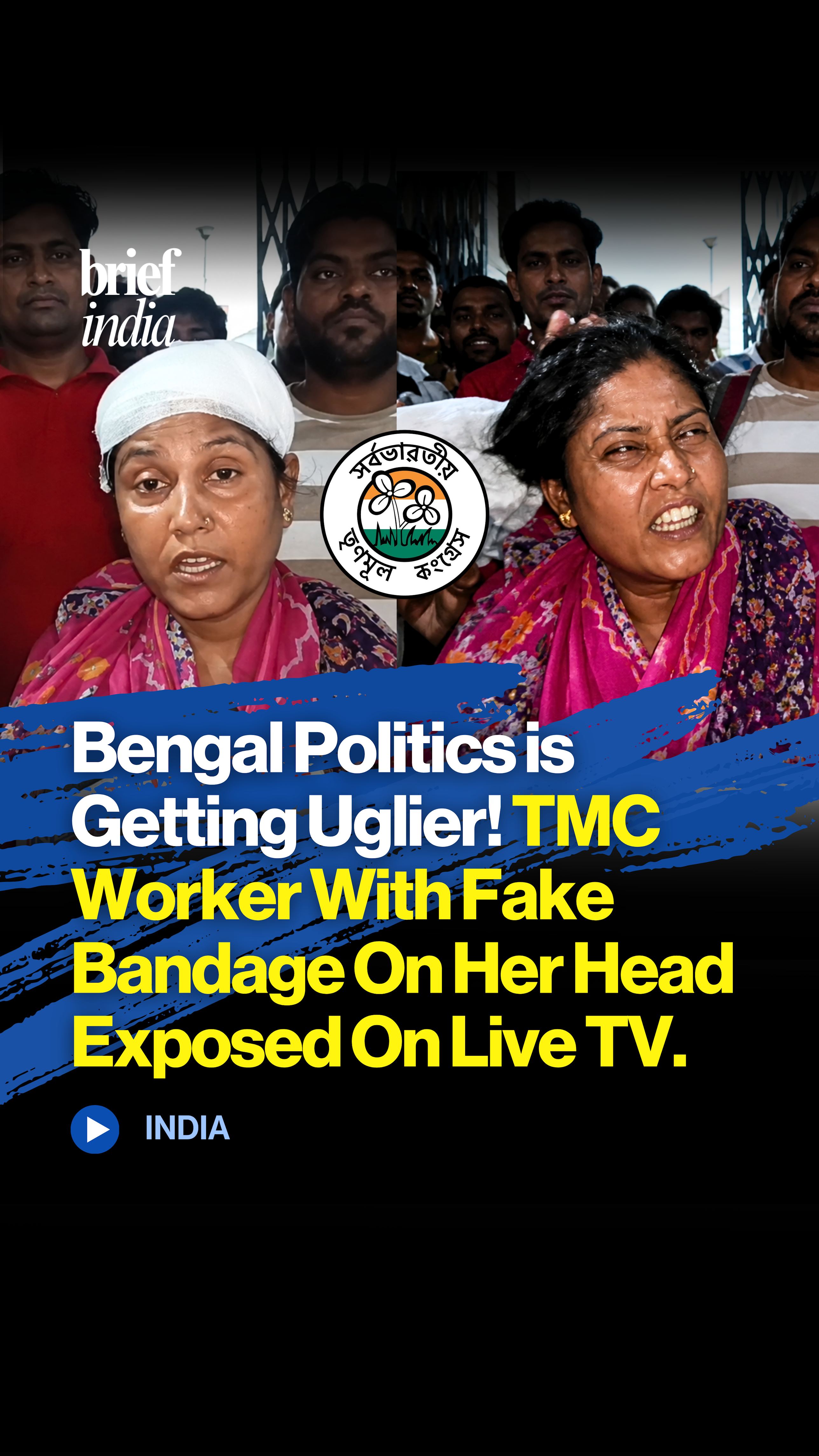 Fake injury exposed live? TMC worker’s bandage sparks viral debate