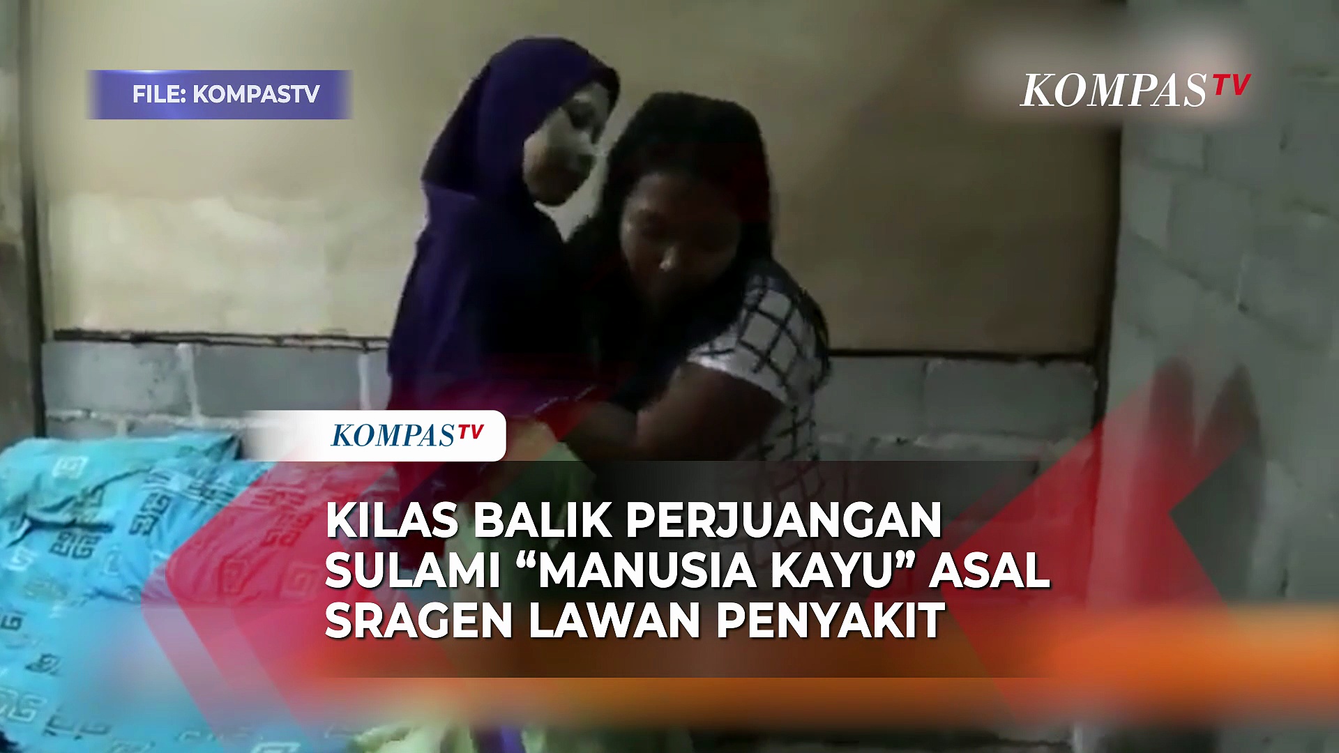 Intip lagi kisah Sulami manusia kayu asal Sragen lawan penyakit jadi ...