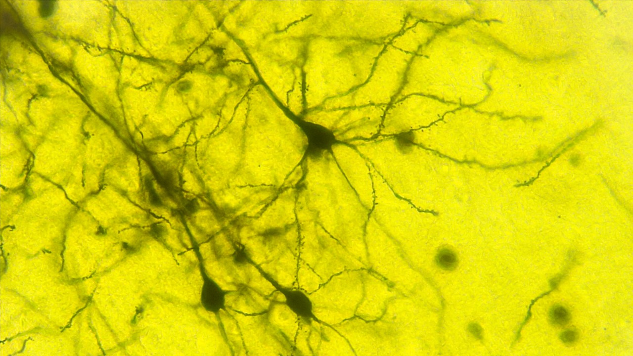Scientists find a way to force the brain to clean its own Alzheimer’s ...