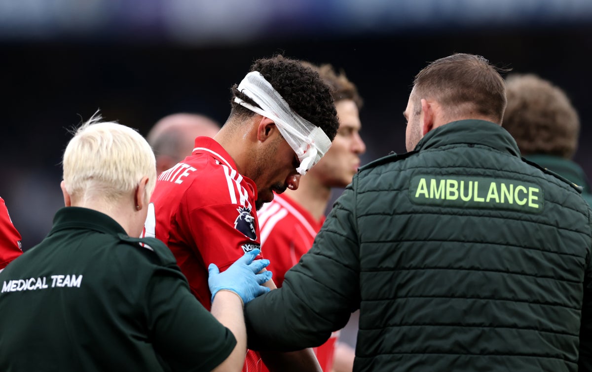 Why is Gibbs-White wearing face mask against Man Utd?