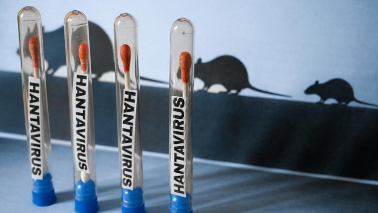 Is hantavirus contagious? Outbreak updates, treatment information ...